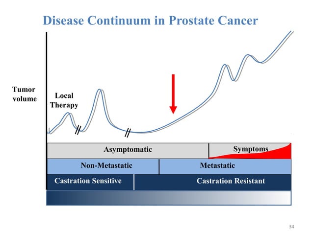Prostate cancer | PPT