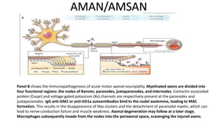 Gullian Barre Syndrome.pptx