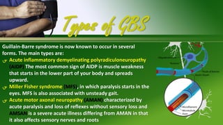 Gullien barre syndrom (issac james gbs) pdf | PPT