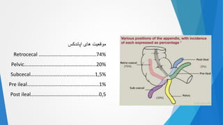 appendicitis | PPT