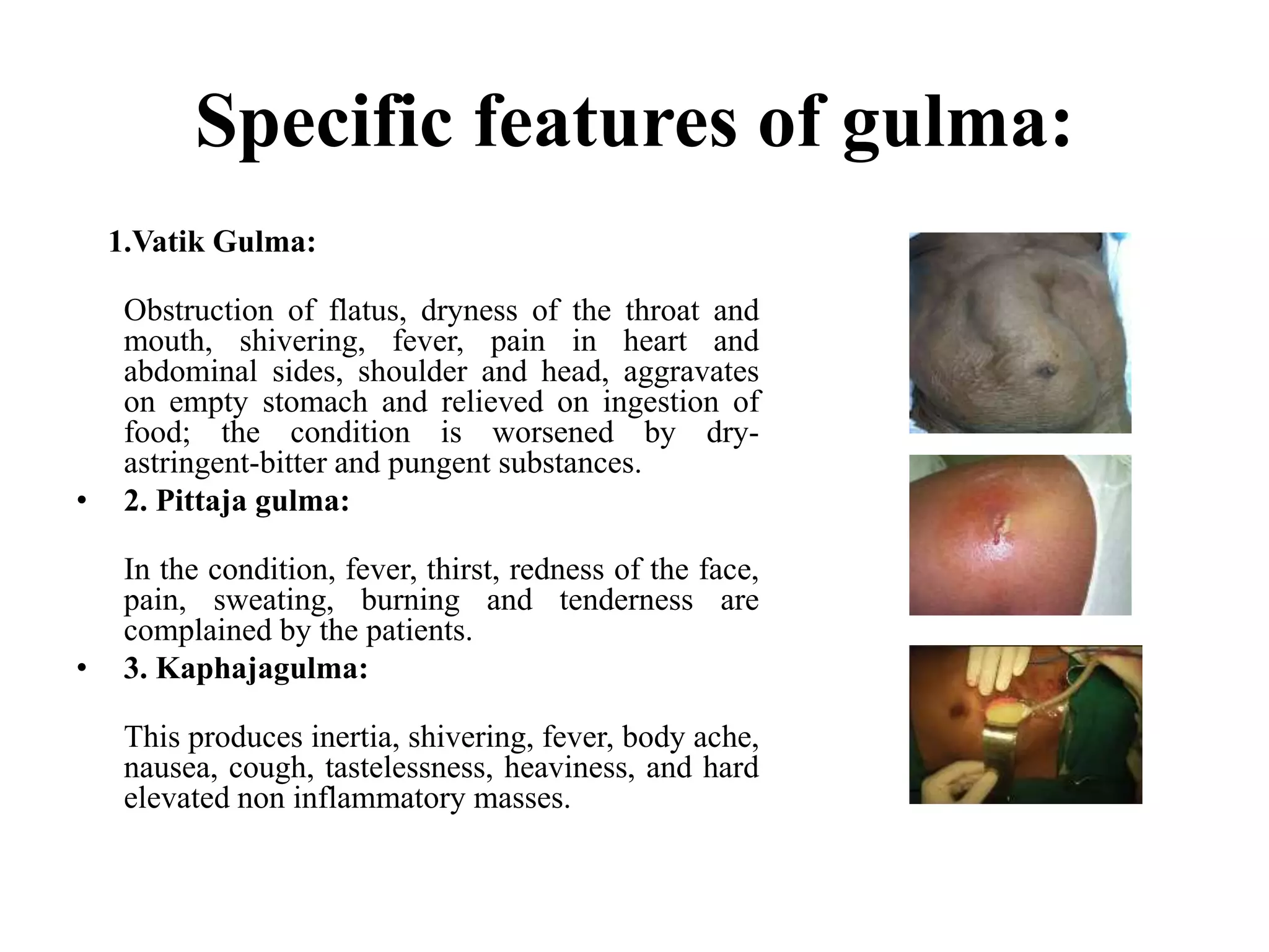 Gulma | PPTX