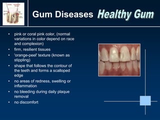 Gum Diseases | PPTX
