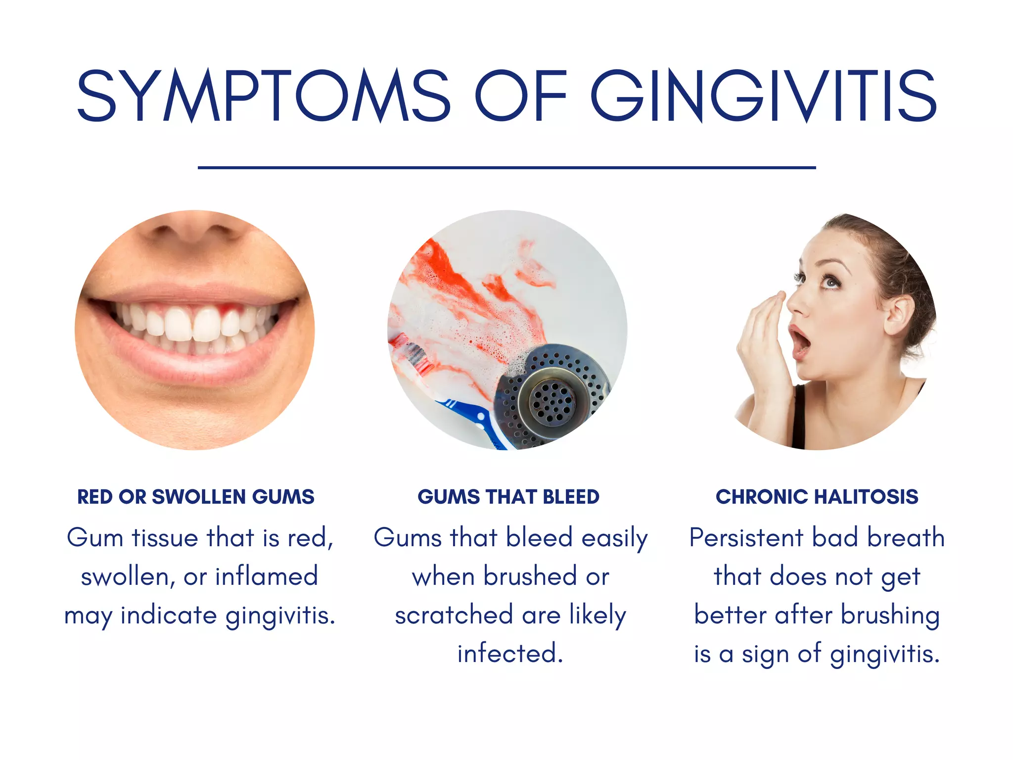 Gum Disease: An Overview | PDF