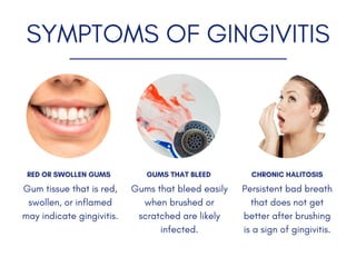 Gum Disease: An Overview | PPT