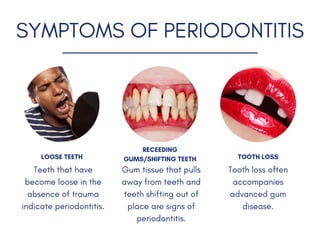 Gum Disease: An Overview | PDF | Dental Health | Diseases and Conditions