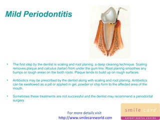 Gum disease treatment | PPT