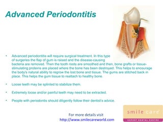 Gum disease treatment | PPT