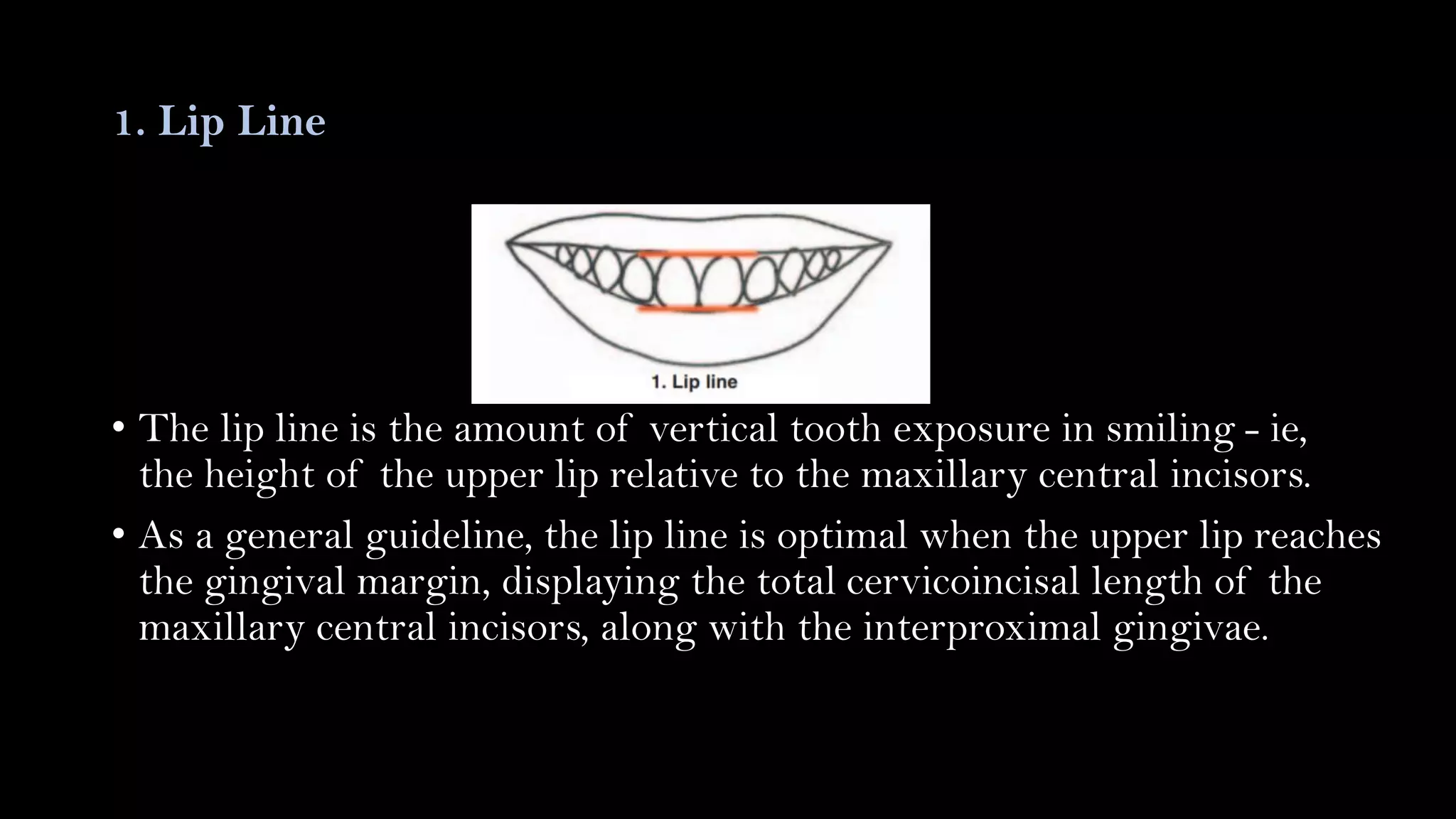 Management of Gummy smile | PDF
