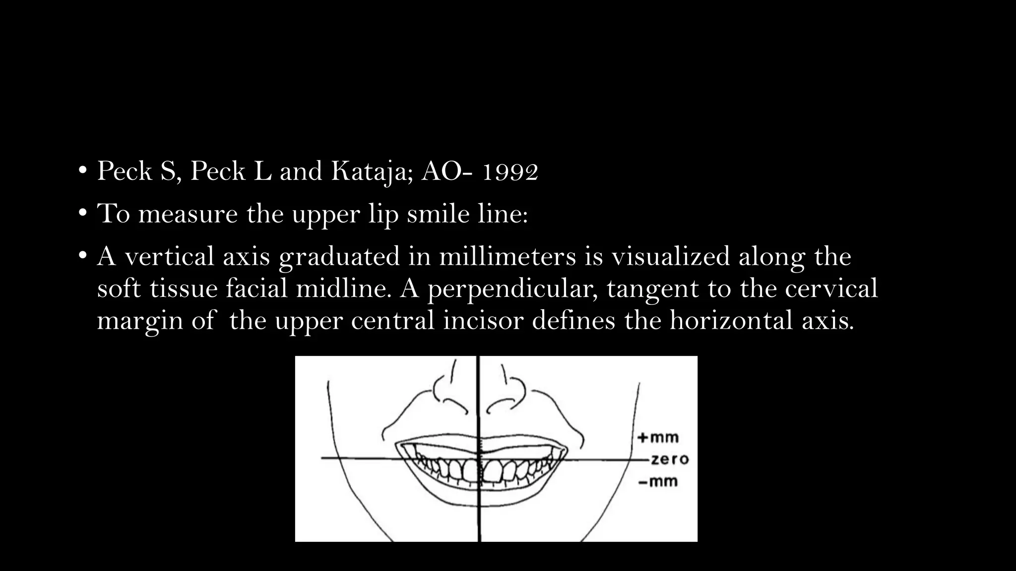 Management of Gummy smile | PDF