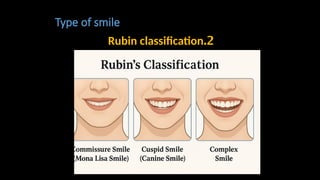 Gummy Smile causes types clasfications treatment options.pptx