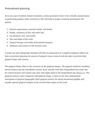 Gummy Smile Correction with Diode Laser- Two Case Reports - PMC.pdf