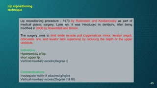 Gummy smile ppt | PPTX