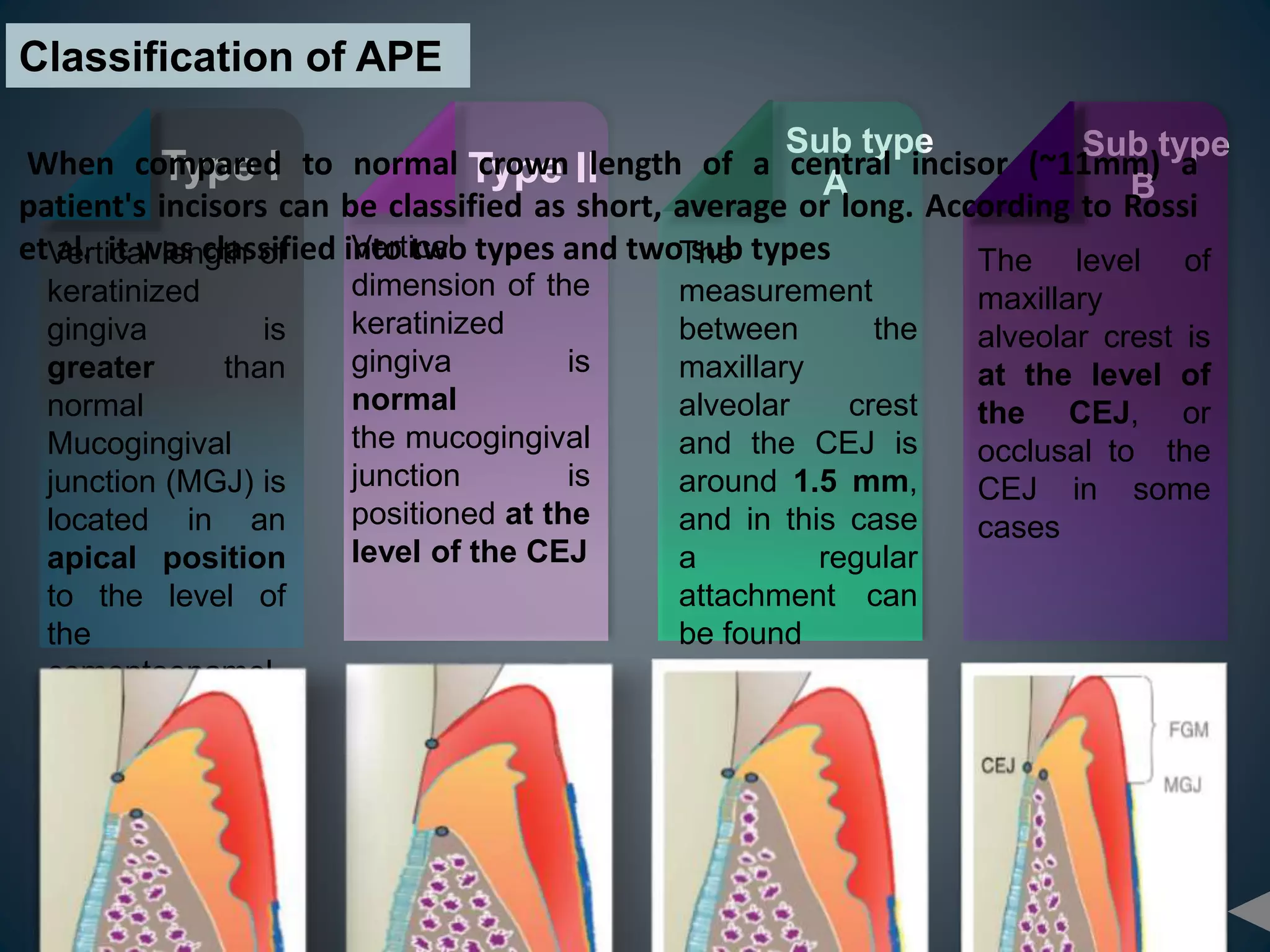 Gummy Smile with Evidence in Orthodontics.pptx