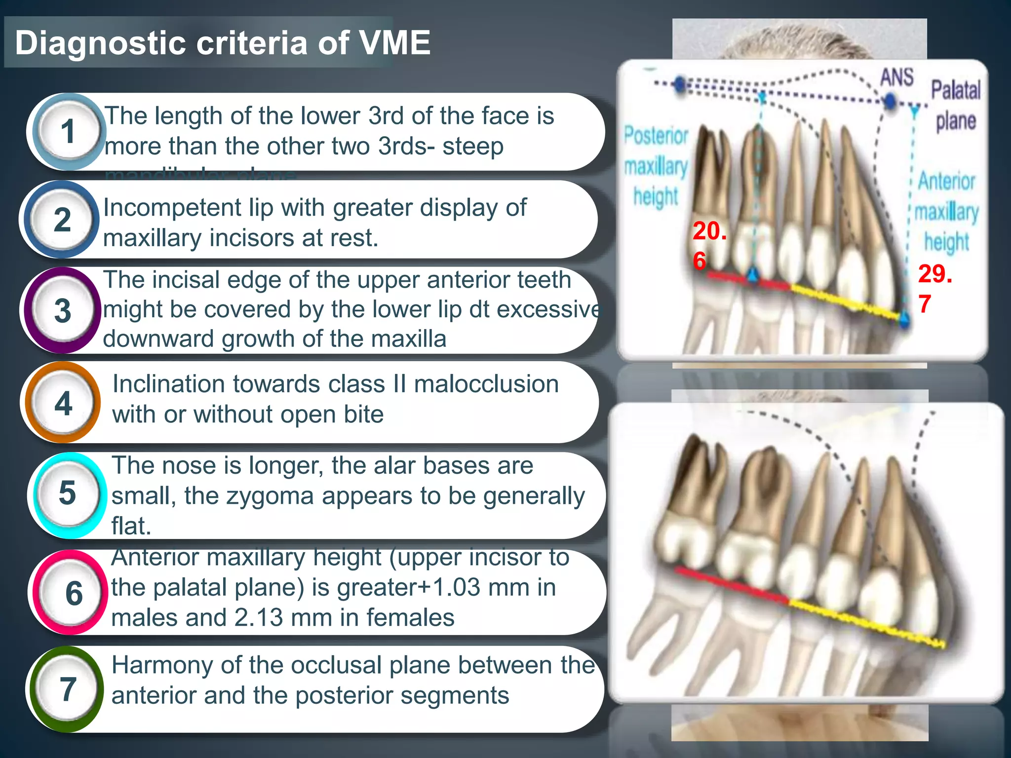 Gummy Smile with Evidence in Orthodontics.pptx