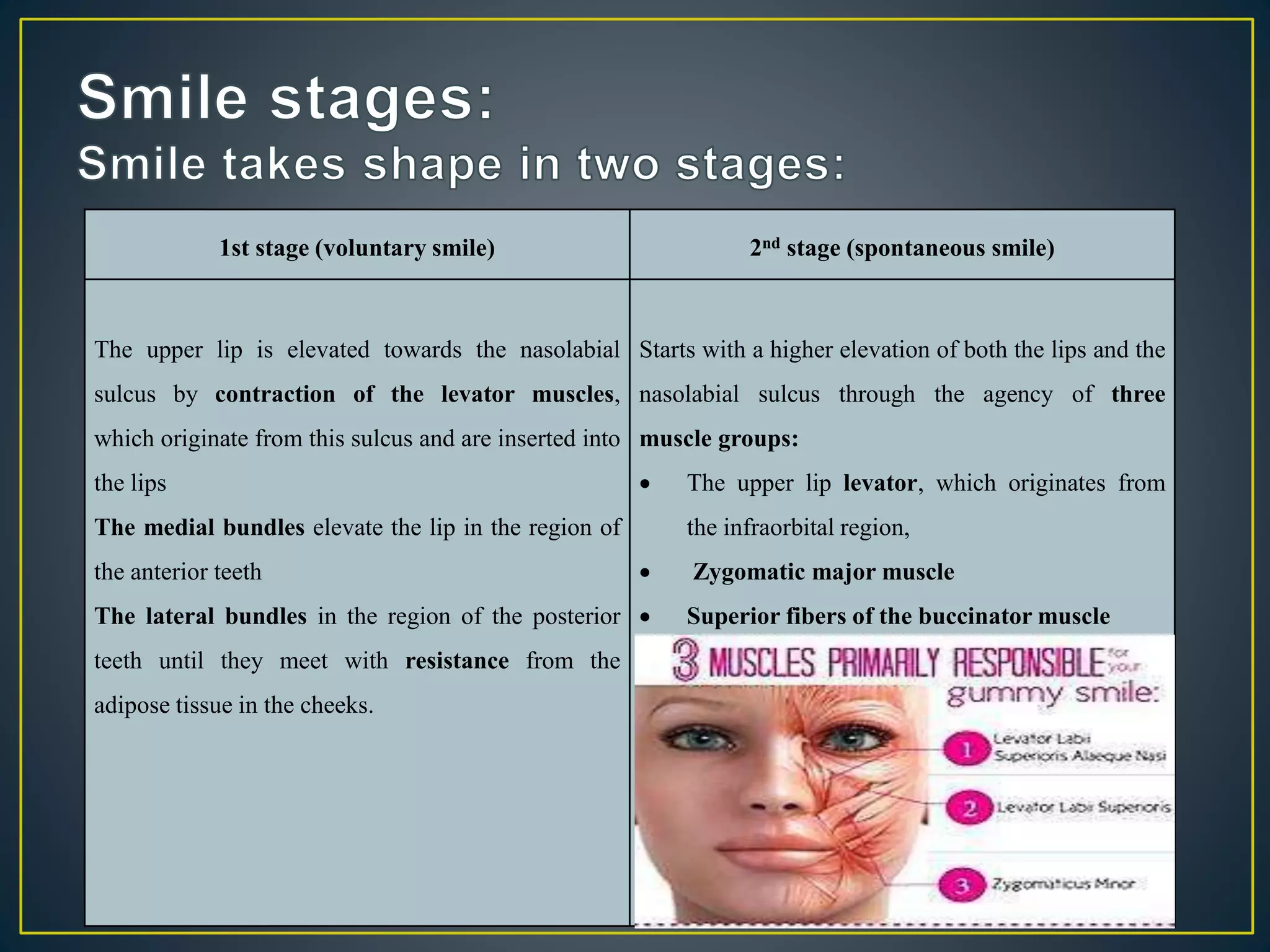 Gummy Smile with Evidence in Orthodontics.pptx