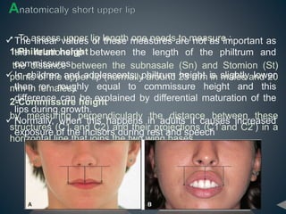Gummy Smile with Evidence in Orthodontics.pptx