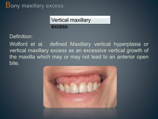 Gummy Smile with Evidence in Orthodontics.pptx
