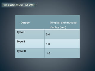 Gummy Smile with Evidence in Orthodontics.pptx