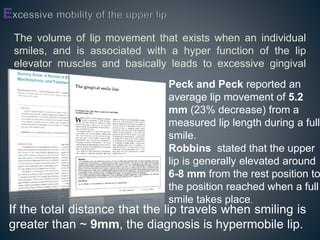 Gummy Smile with Evidence in Orthodontics.pptx