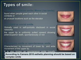 Gummy Smile with Evidence in Orthodontics.pptx