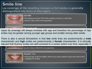 Gummy Smile with Evidence in Orthodontics.pptx