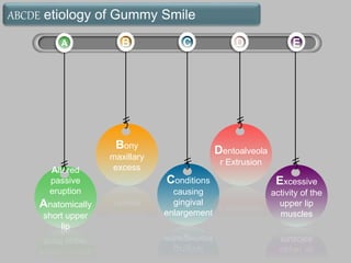 Gummy Smile with Evidence in Orthodontics.pptx