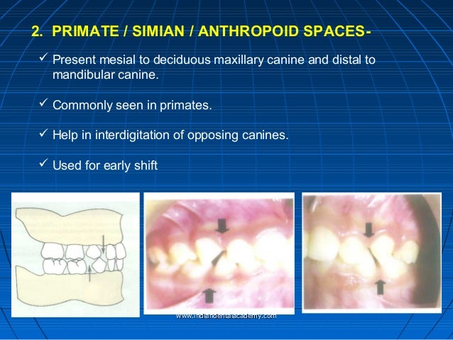 Gum pads,devp of primary dentition..