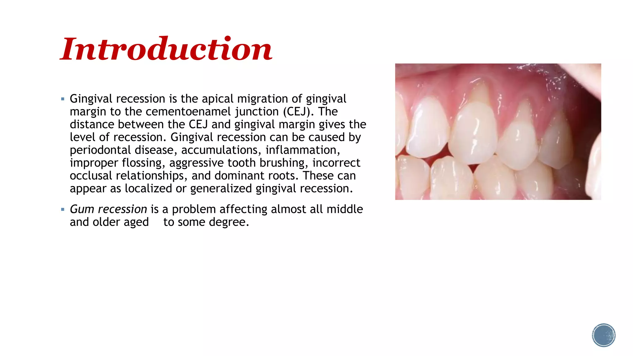 Gingival Recession | PPT