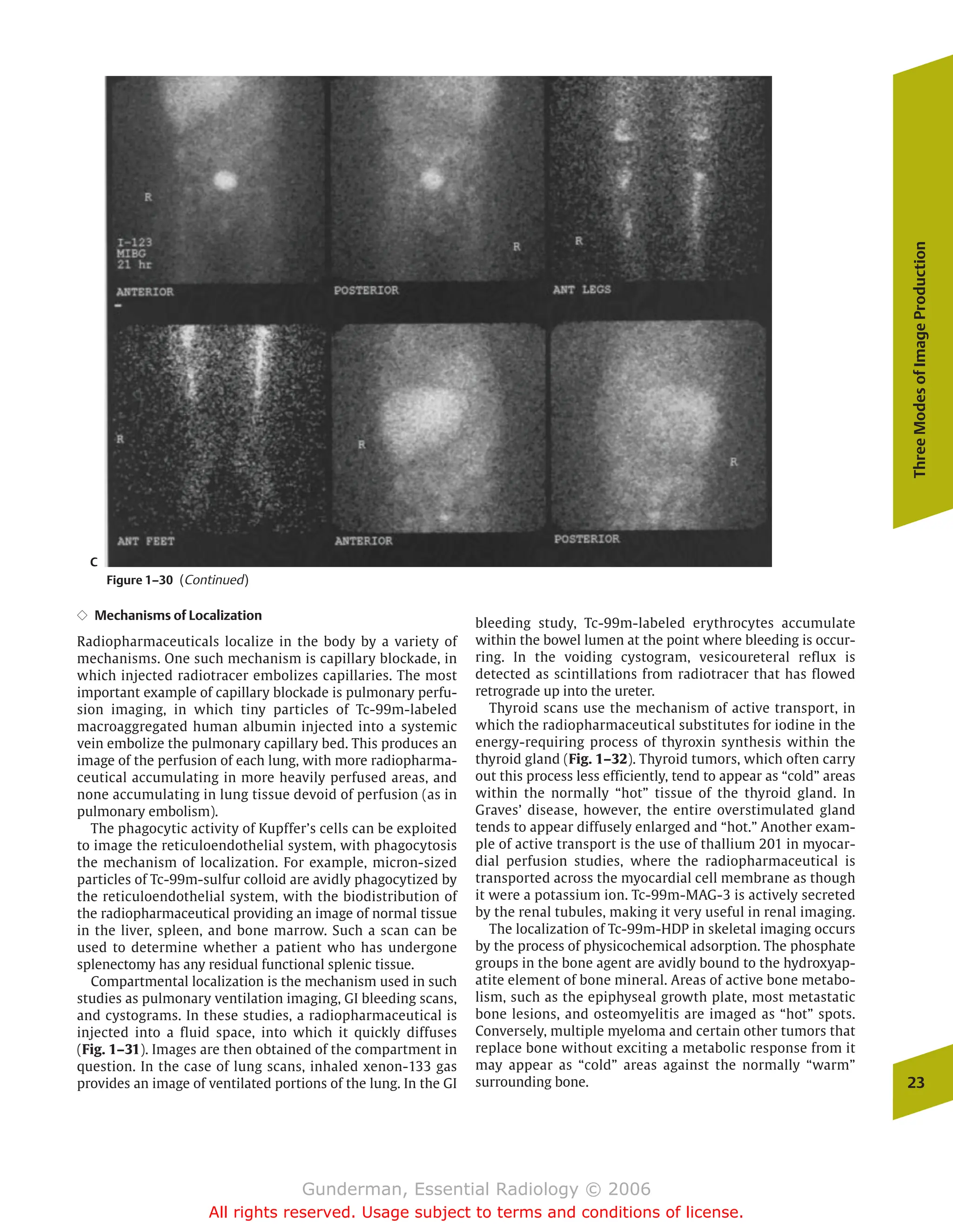 Gunderman - Essential Radiology - Second Edition.pdf