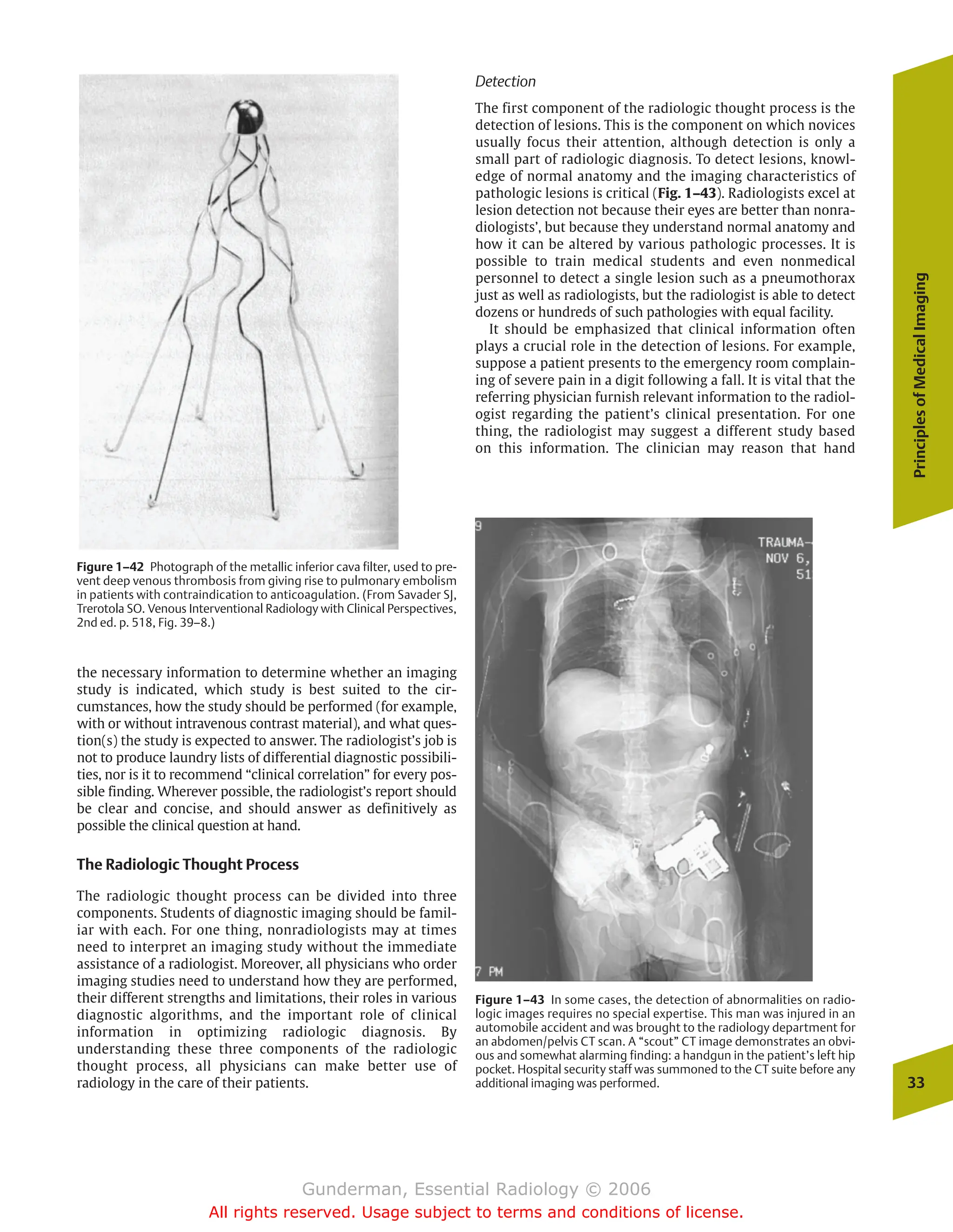 Gunderman - Essential Radiology - Second Edition.pdf