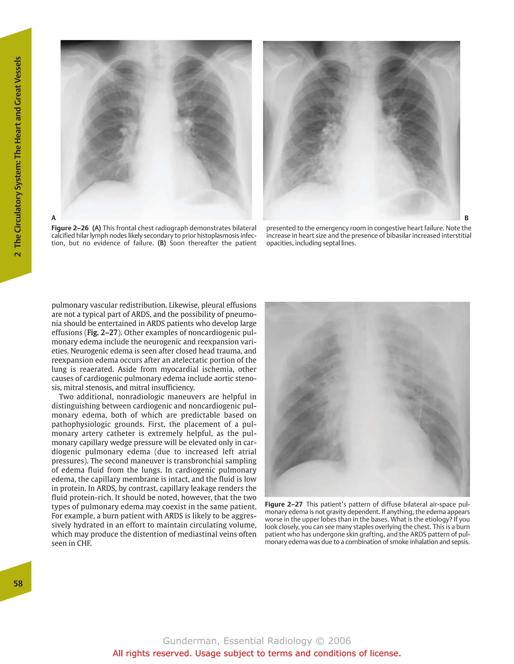 Gunderman - Essential Radiology - Second Edition.pdf