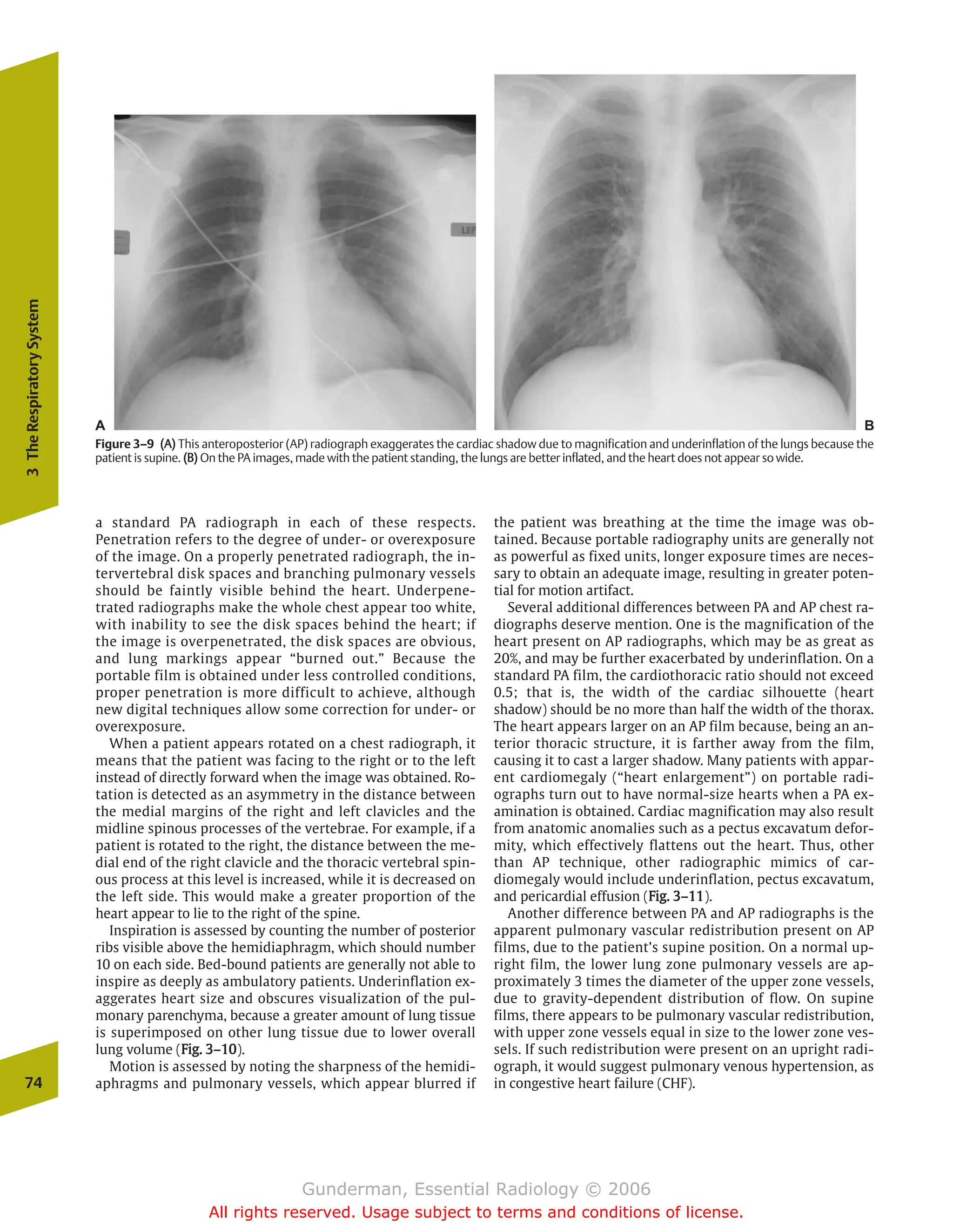 Gunderman - Essential Radiology - Second Edition.pdf