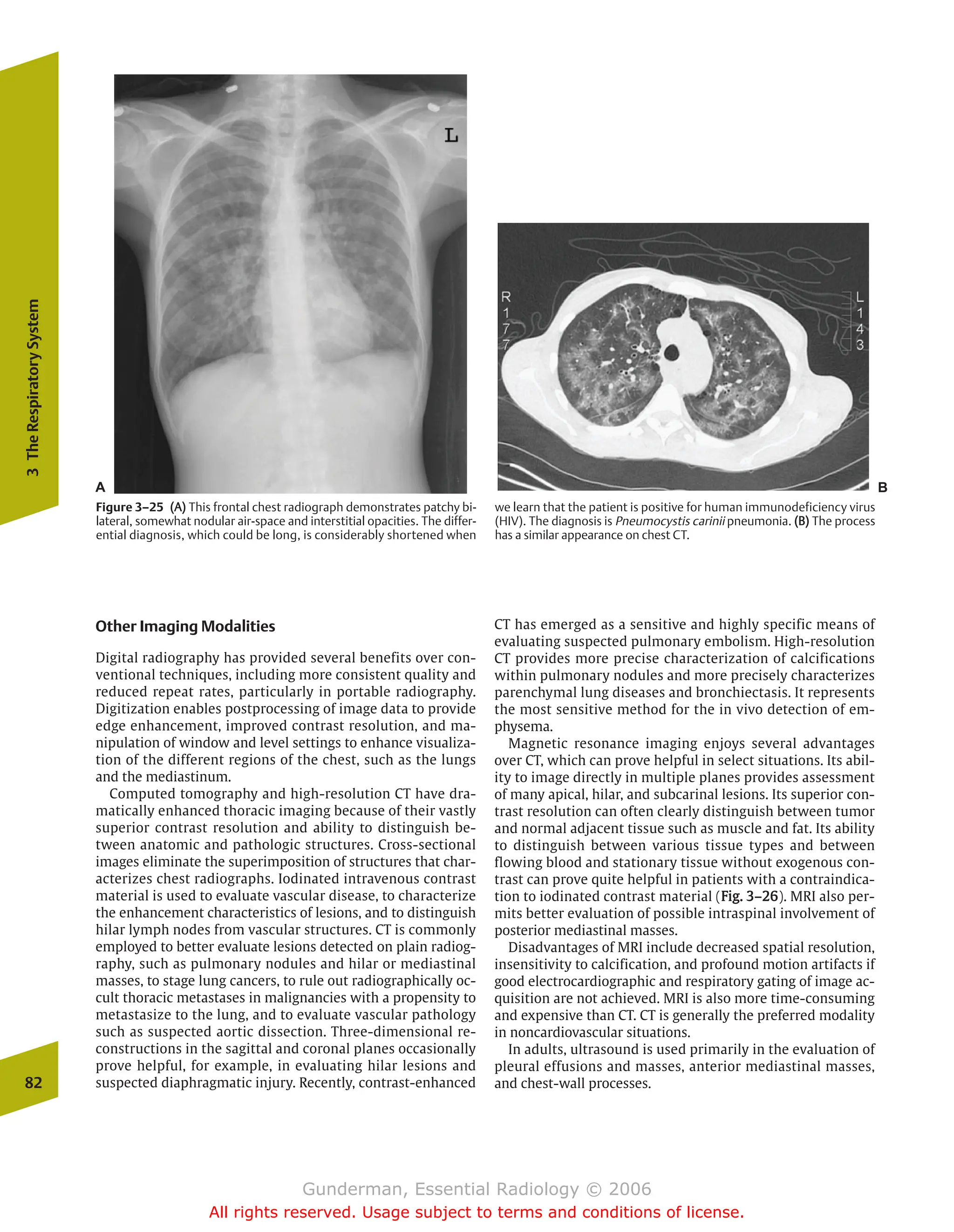 Gunderman - Essential Radiology - Second Edition.pdf