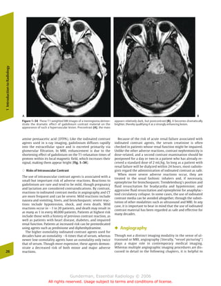Gunderman - Essential Radiology - Second Edition.pdf