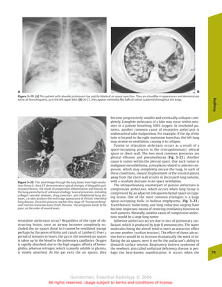 Gunderman - Essential Radiology - Second Edition.pdf