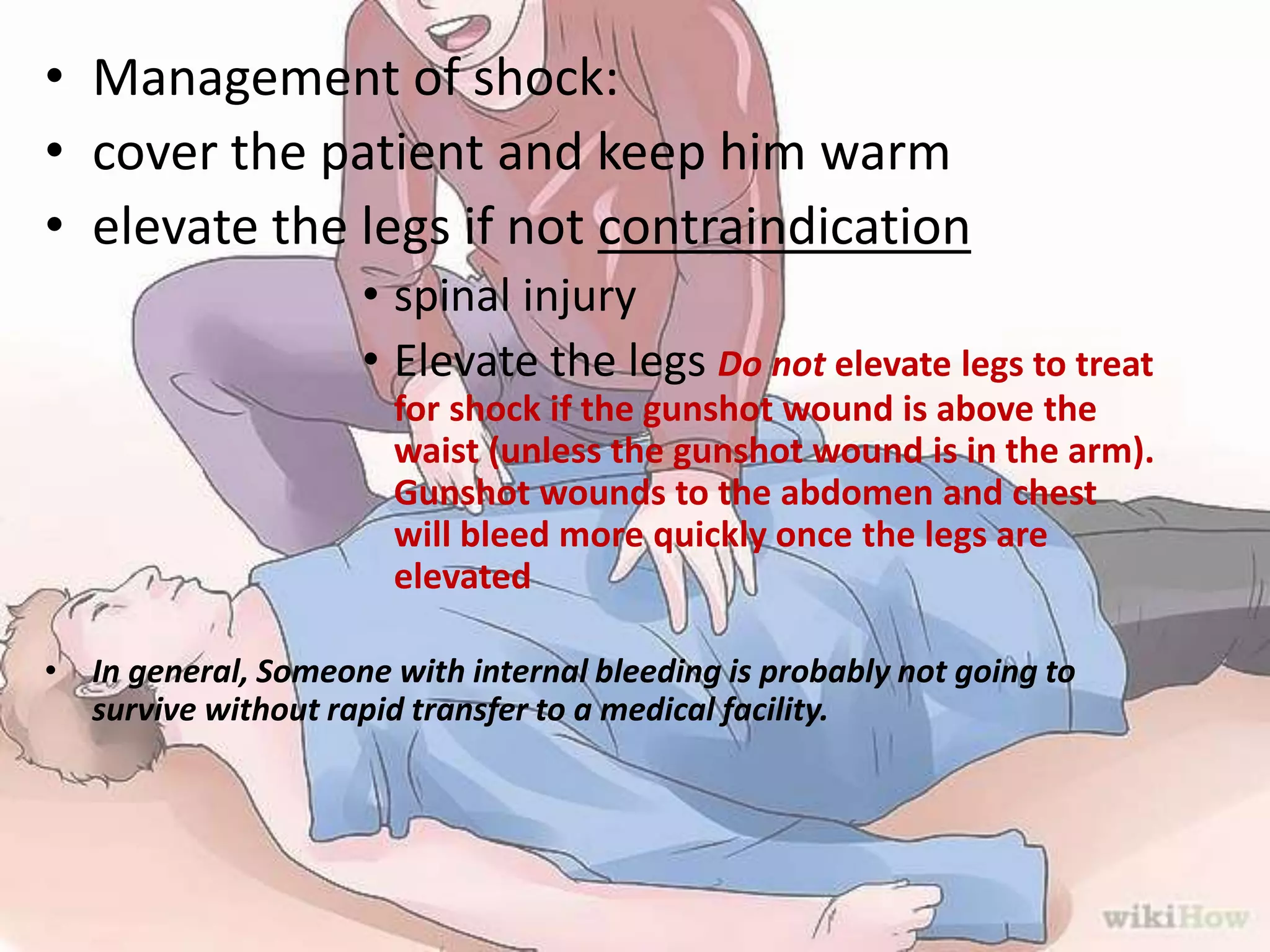 Gunshot first aid | PPTX