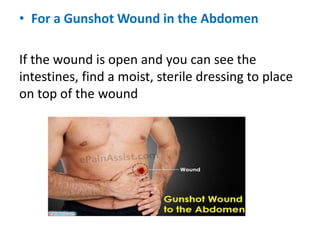 Gunshot first aid | PPTX