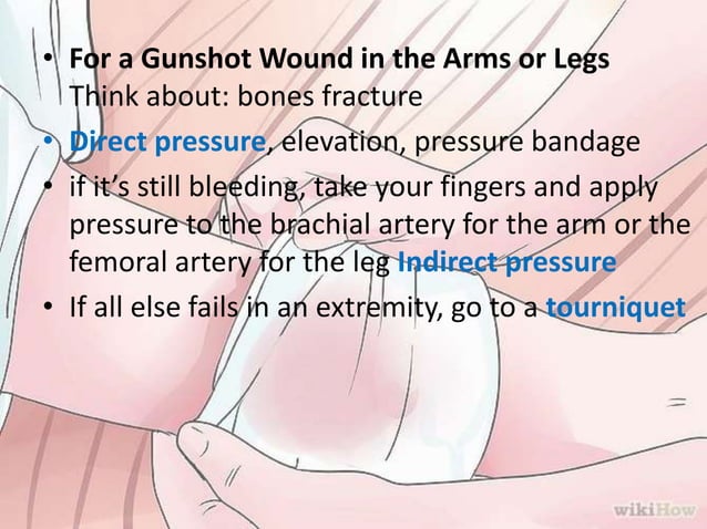 Gunshot first aid | PPTX | First Aid | Injuries