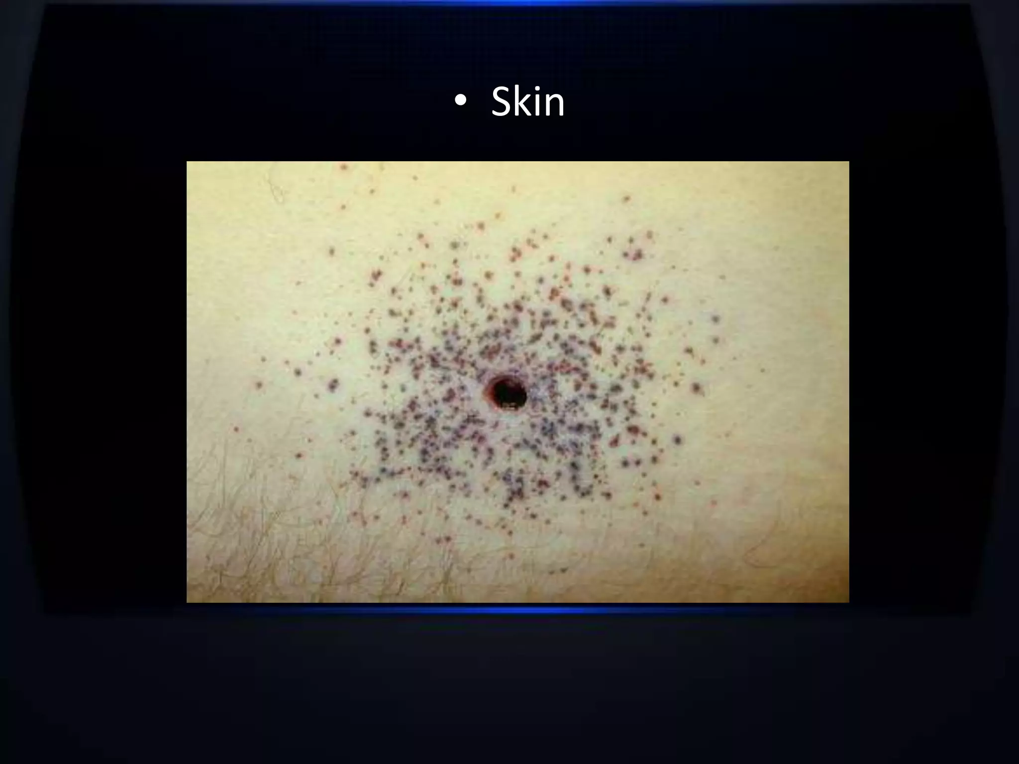 Gun Shot Residue Ppt