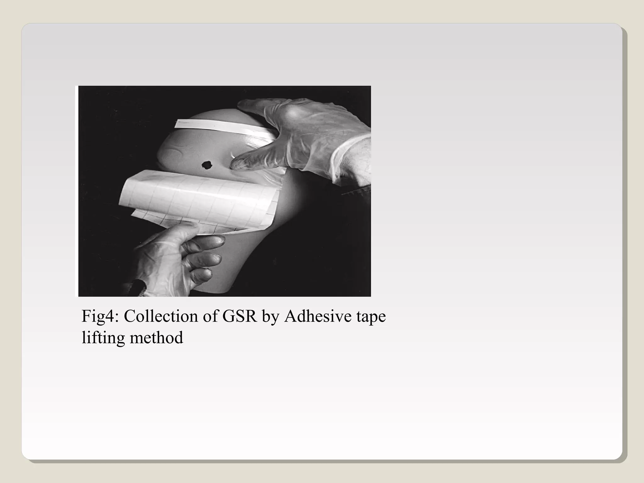 Gunshot residue, forensic analysis and interpretation ppt 03 | PPT