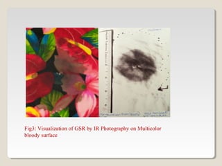 Gunshot residue, forensic analysis and interpretation ppt 03 | PPT