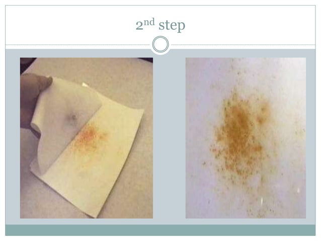 Chemical tests for GSR | PPTX | Arms & Ammunition | Sensitive Topics