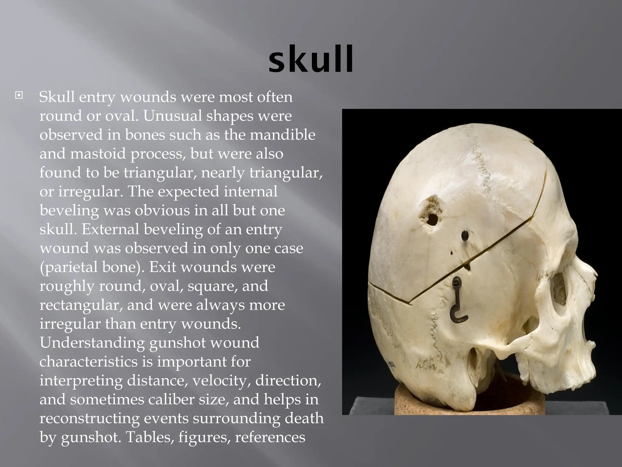 Gunshot Trauma it’s mechanism of injury and it’s classification | PPTX