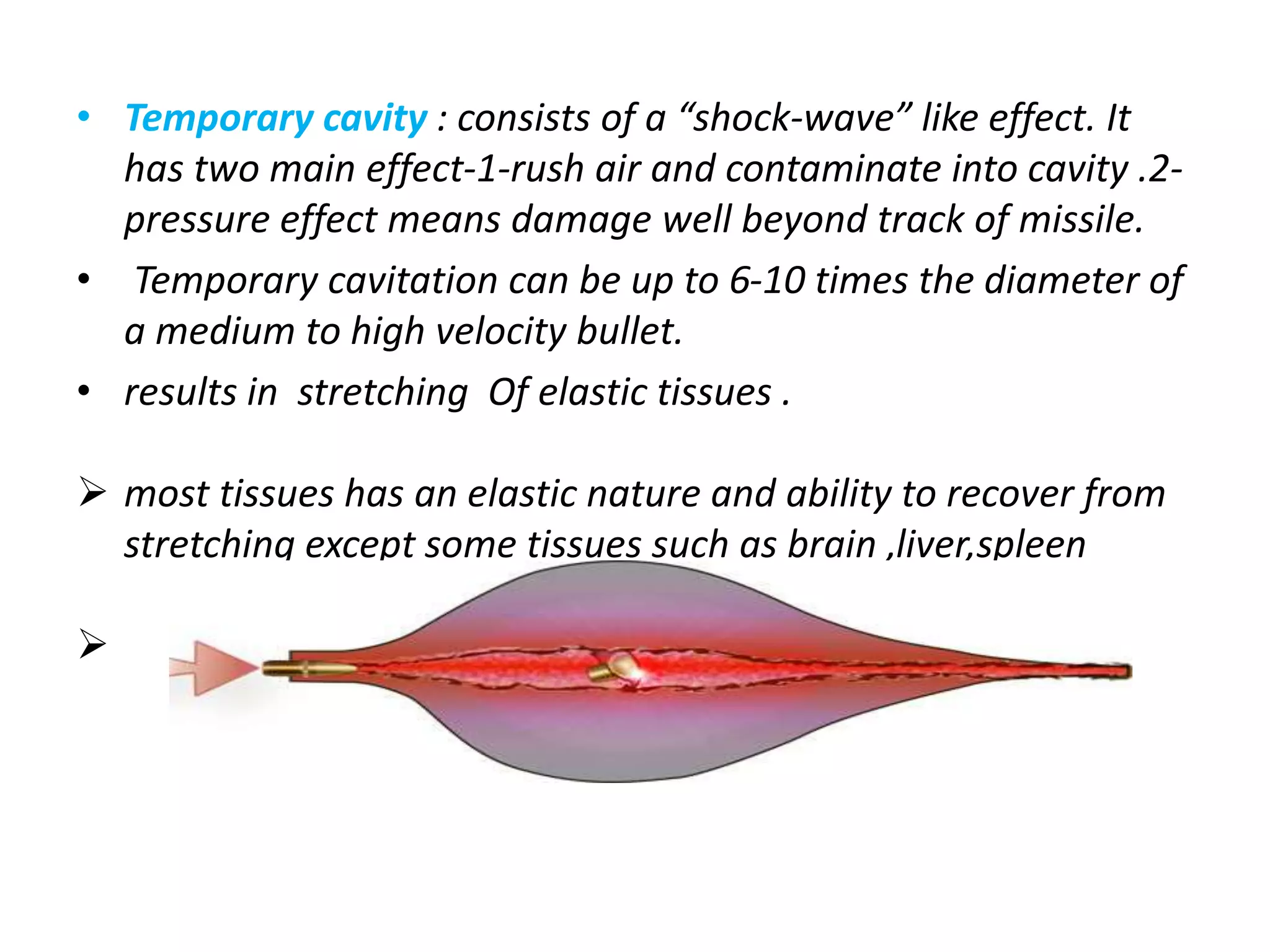 Gun shot wounds | PPTX
