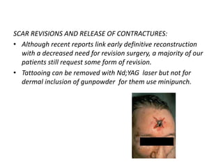 Gun shot wounds | PPTX