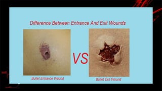 GUNSHOT WOUNDS (1).pptx