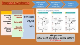 PEDIATRIC SUDDEN CARDIAC DEATH, SYNCOPE, INHERITABLE ARRHYTHMIAS | PPTX ...
