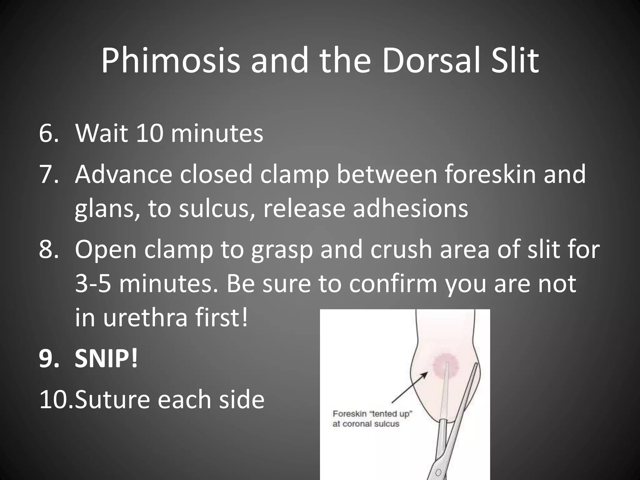 Urologic Procedures in the Emergency Department | PPTX