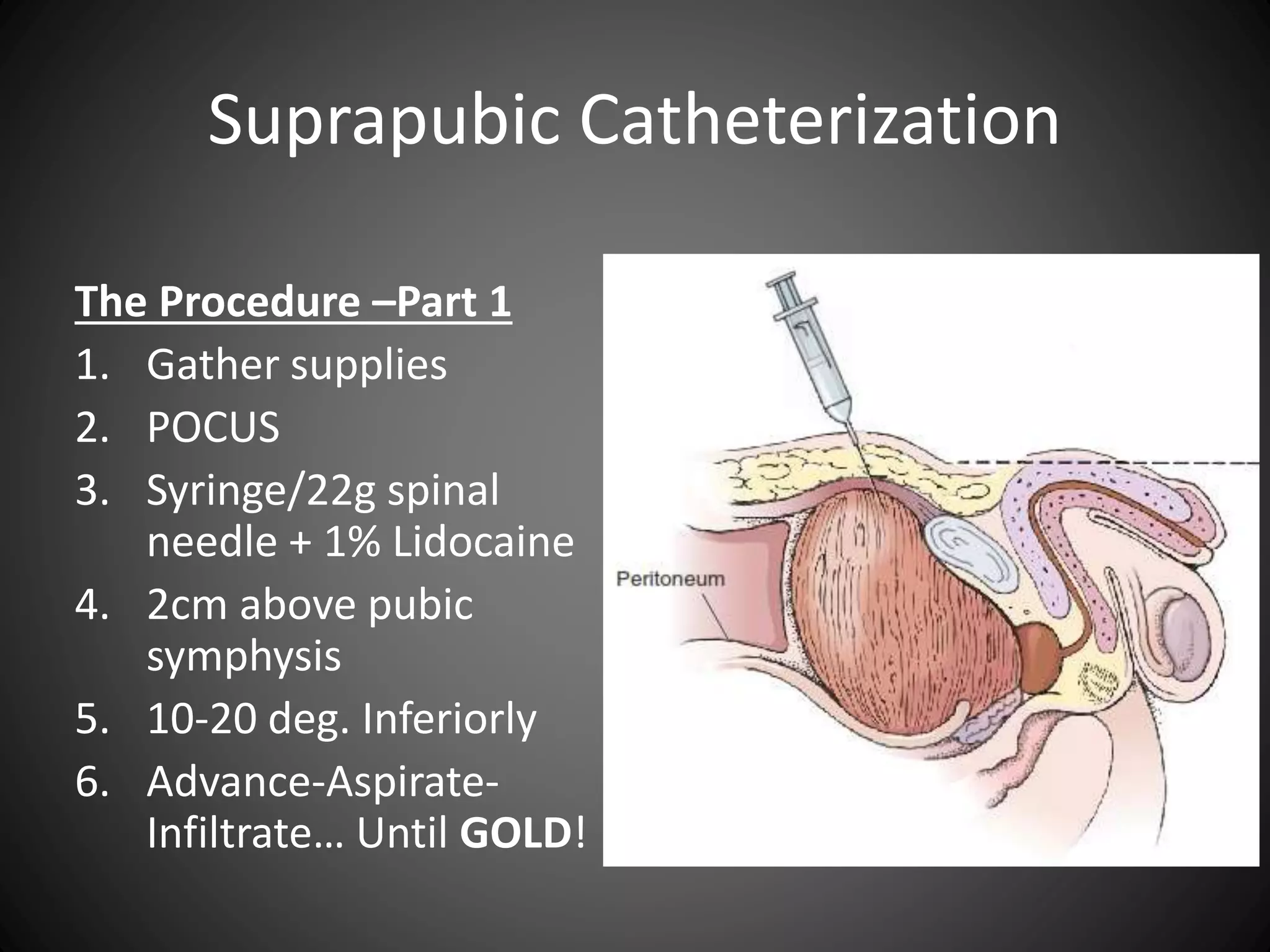 Urologic Procedures in the Emergency Department | PPTX