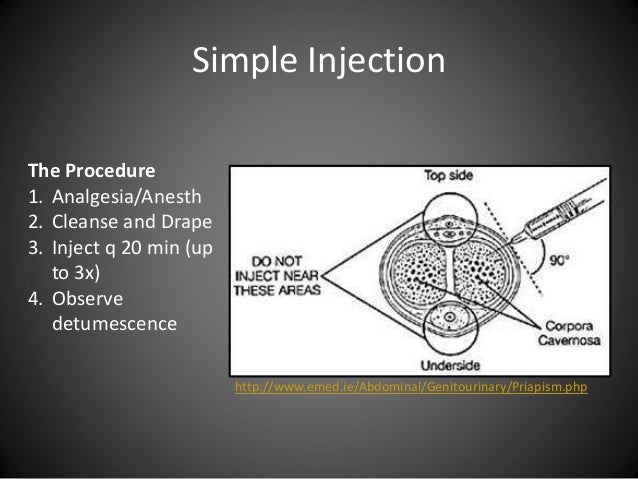 Urologic Procedures in the Emergency Department